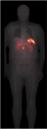 Diagnostics | Topical Collection : Hybrid Imaging in Medicine