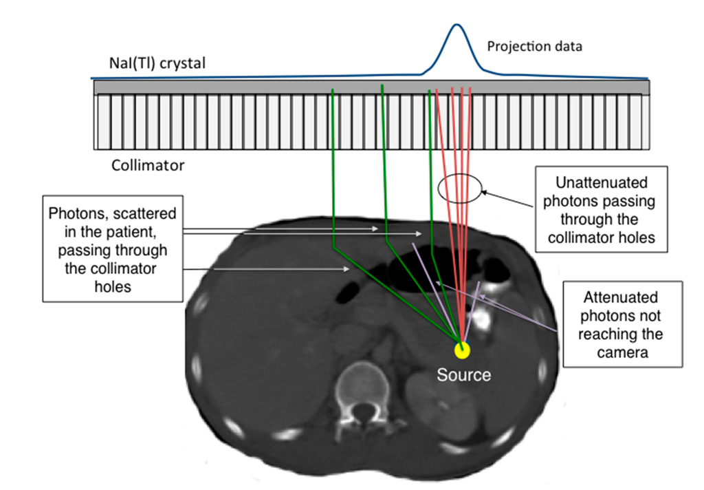 Hybrid Imaging for Patient-Specific Dosimetry in Radionuclide Therapy