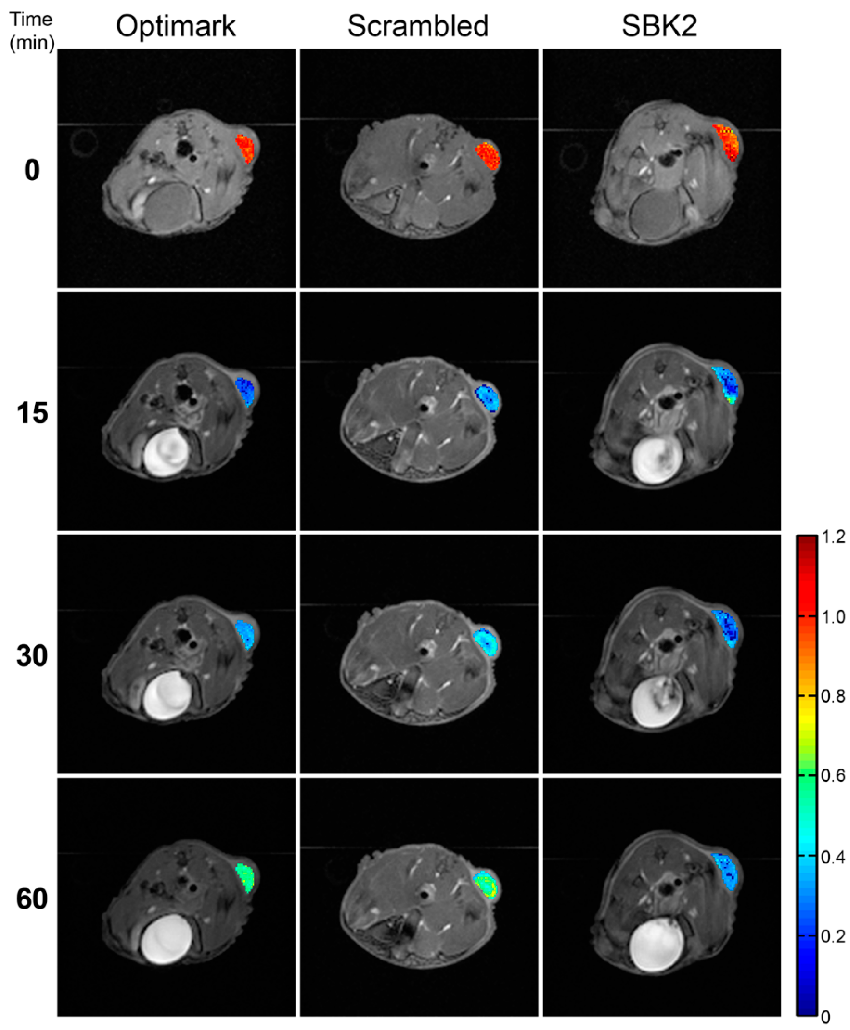 Molecular Imaging of Tumors Using a Quantitative T1 Mapping Technique via Magnetic Resonance Imaging