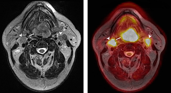 Diagnostics | Topical Collection : Hybrid Imaging in Medicine