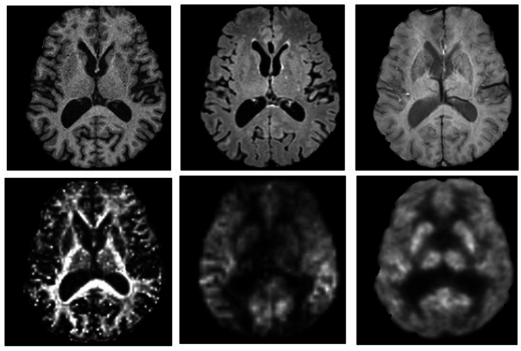 Diagnostics | Topical Collection : Hybrid Imaging in Medicine