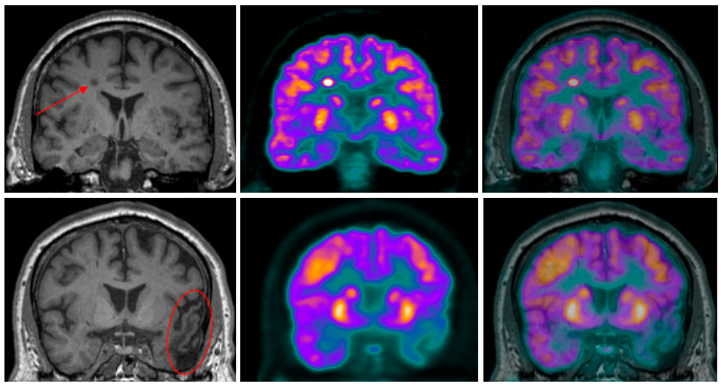 Diagnostics | Topical Collection : Hybrid Imaging in Medicine