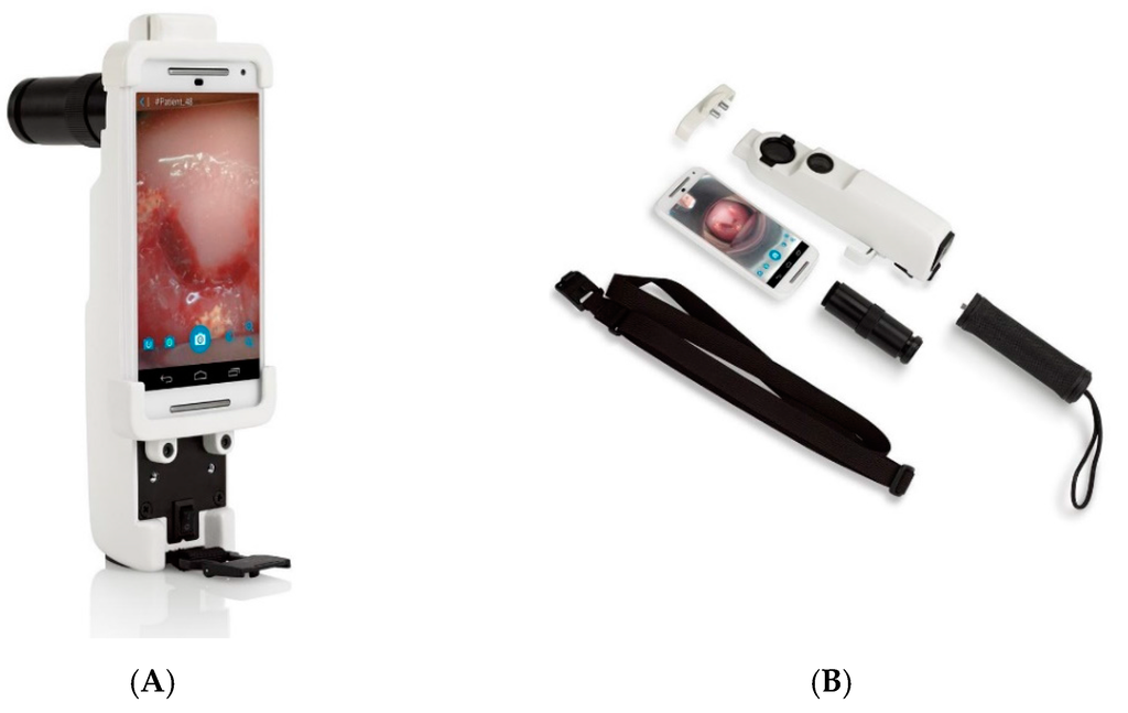 Real-Time Monitoring and Evaluation of a Visual-Based Cervical Cancer ...