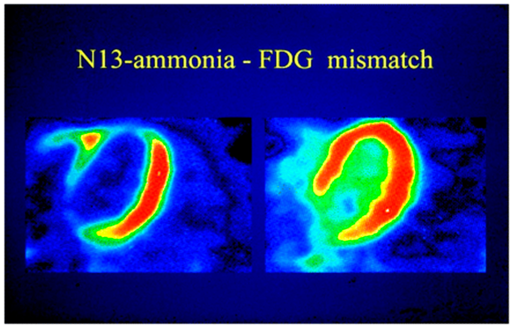 Clinical Utility and Future Applications of PET/CT and PET/CMR in ...