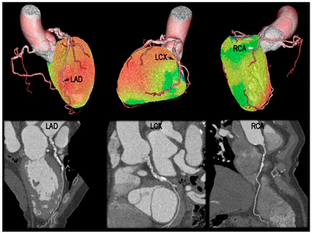 Clinical Utility and Future Applications of PET/CT and PET/CMR in ...