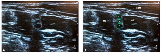 Diagnostics | Special Issue : Diagnosis and Treatment of Thoracic ...
