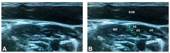 Diagnostics | Special Issue : Diagnosis and Treatment of Thoracic ...