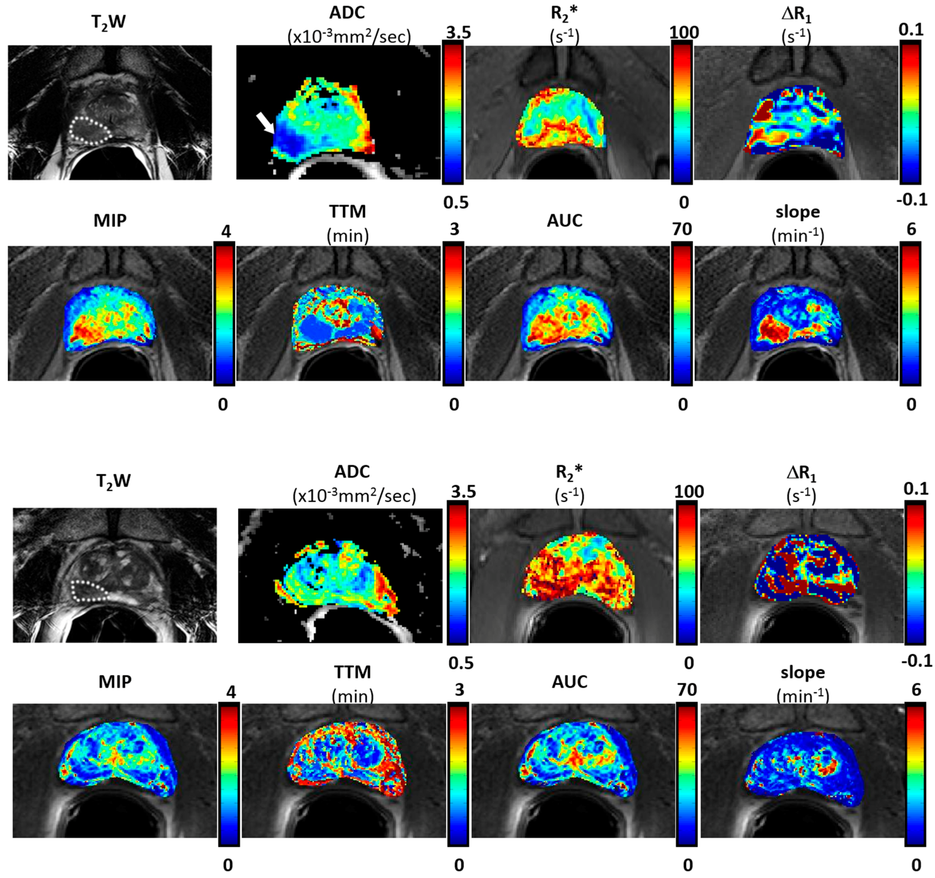 Diagnostics Free Full Text Incorporating Oxygen Enhanced Mri Into