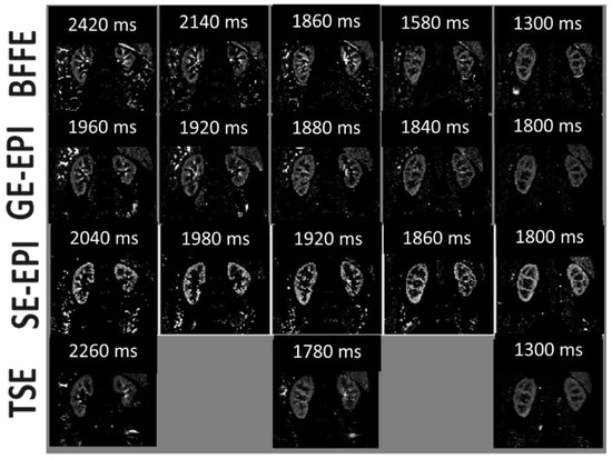 Evaluation of 2D Imaging Schemes for Pulsed Arterial Spin Labeling of ...