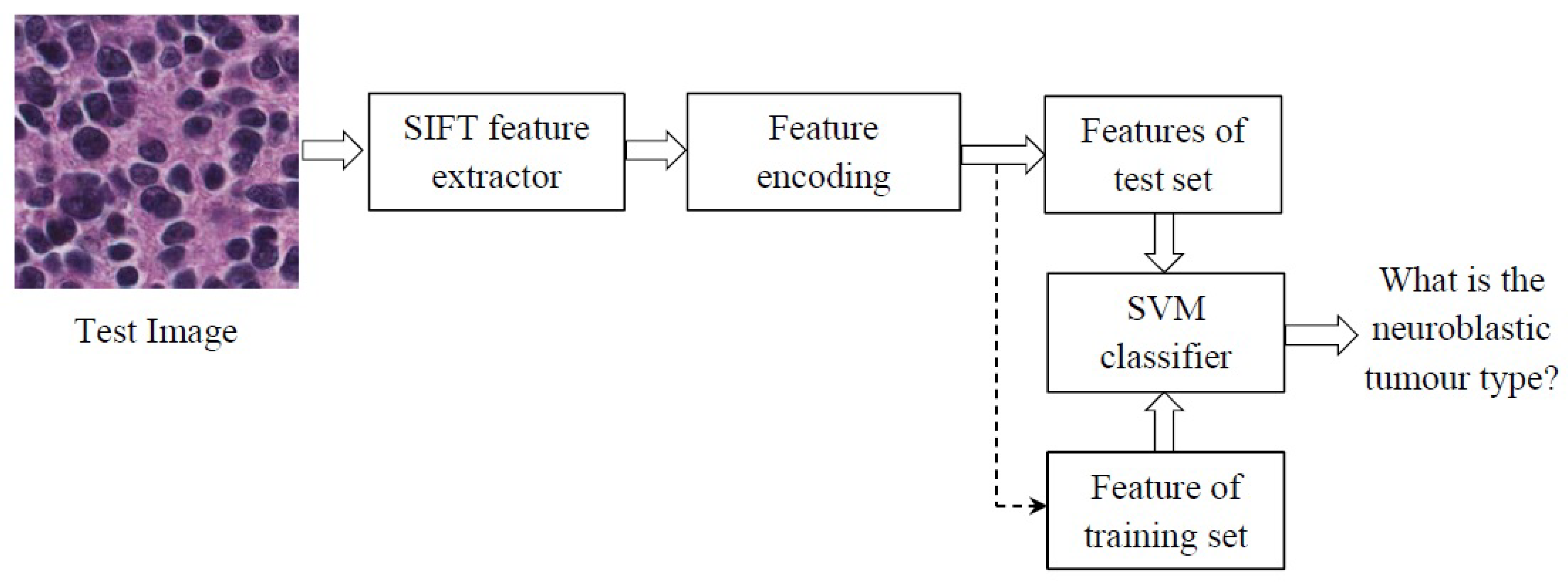 Computer Aided Classification of Neuroblastoma Histological Images Using Scale Invariant Feature ...