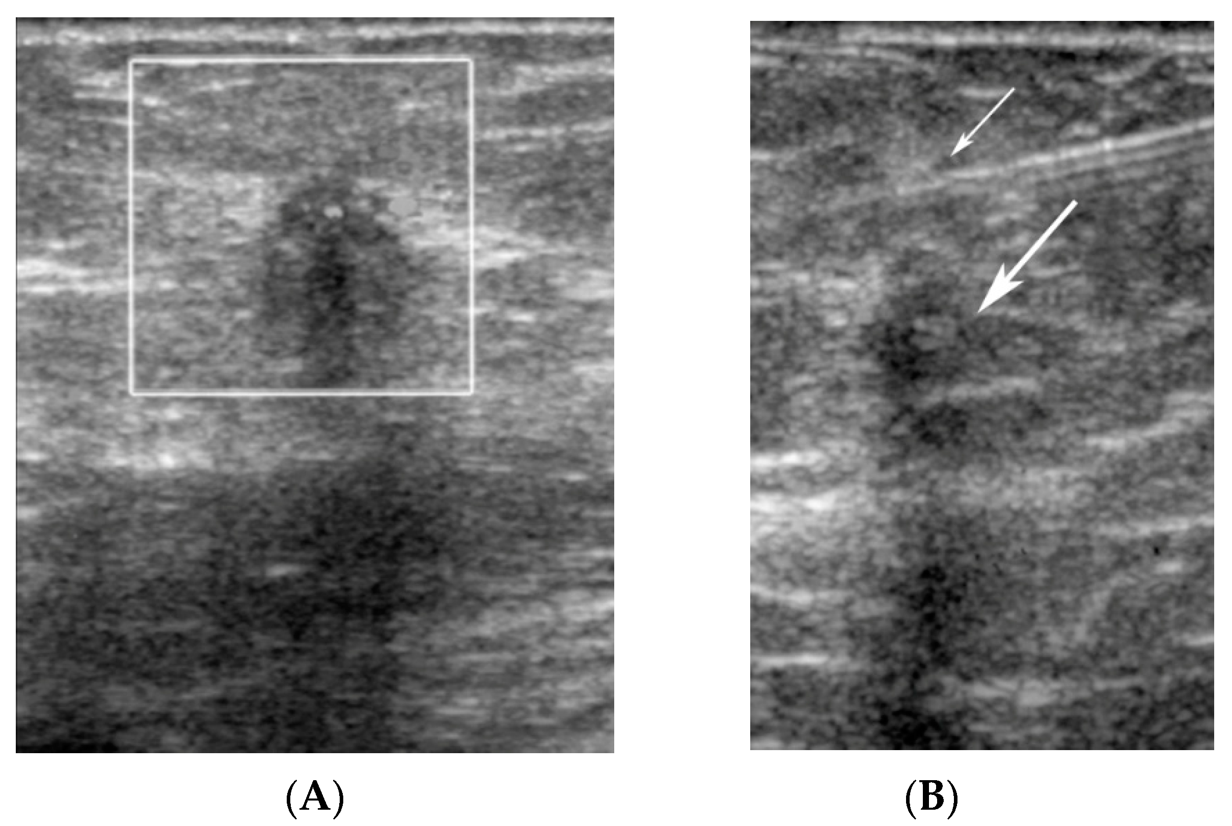 Sentinel Lymph Node Evaluation: What the Radiologist Needs to Know