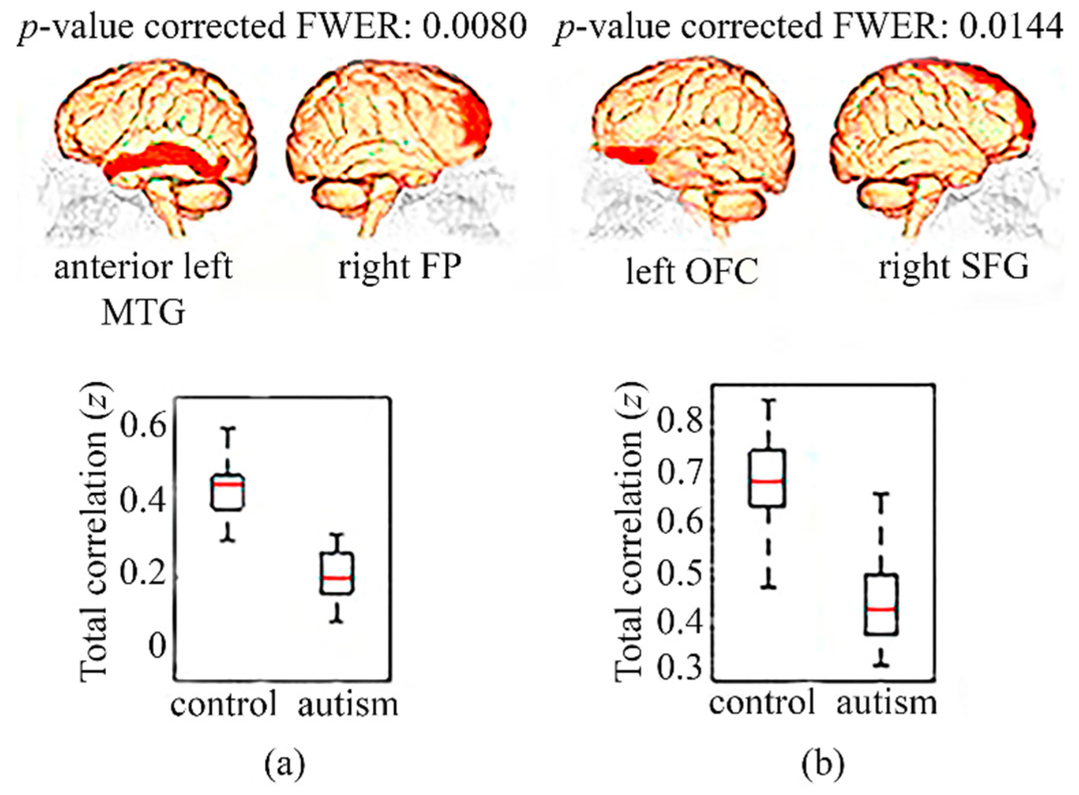 Diagnostics Free Full Text Link Level Functional Connectivity