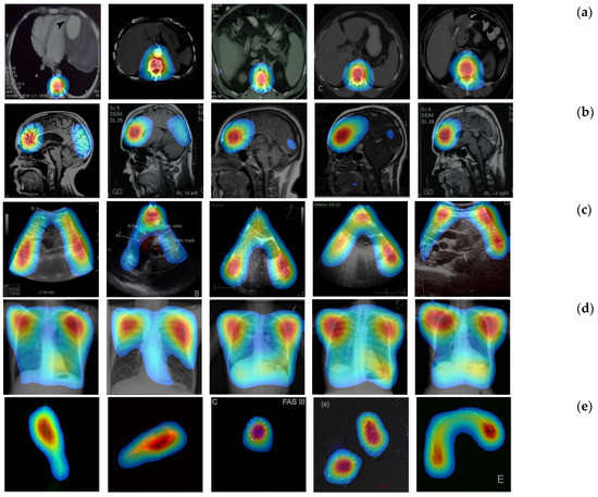 Visual Interpretation of Convolutional Neural Network Predictions in ...
