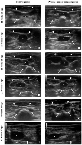 Anatomy and Imaging of Rat Prostate: Practical Monitoring in ...