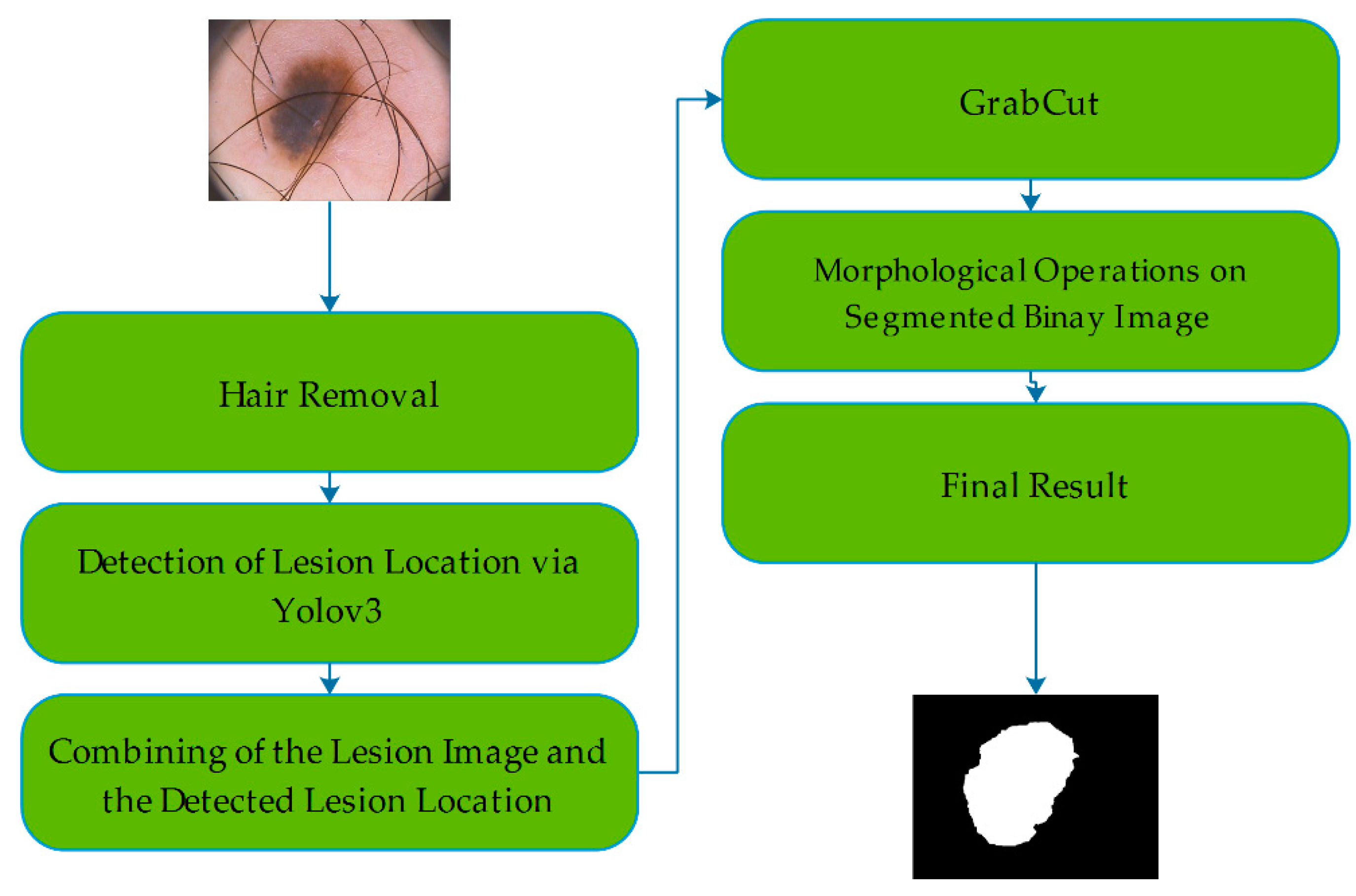 Skin Lesion Segmentation in Dermoscopic Images with Combination of YOLO and GrabCut Algorithm