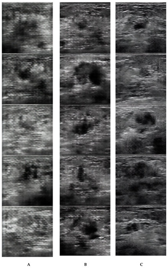 Breast Ultrasound Image Synthesis using Deep Convolutional Generative ...