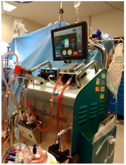 Diagnostics | Free Full-Text | Hyperthermic Intraperitoneal ...