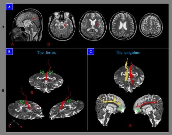 Diagnostics | Free Full-Text | Diagnostic Problems in Diffuse Axonal Injury
