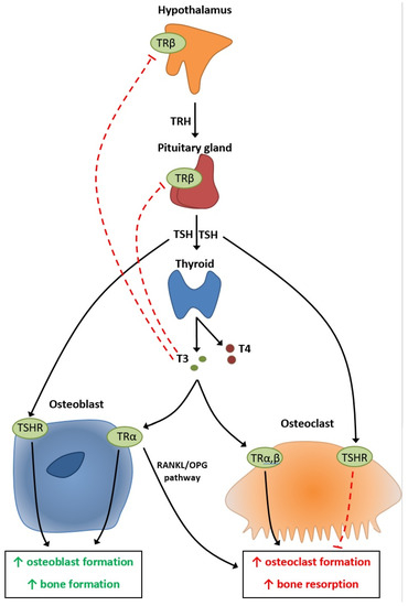 The Influence of Thyroid Pathology on Osteoporosis and Fracture Risk: A ...