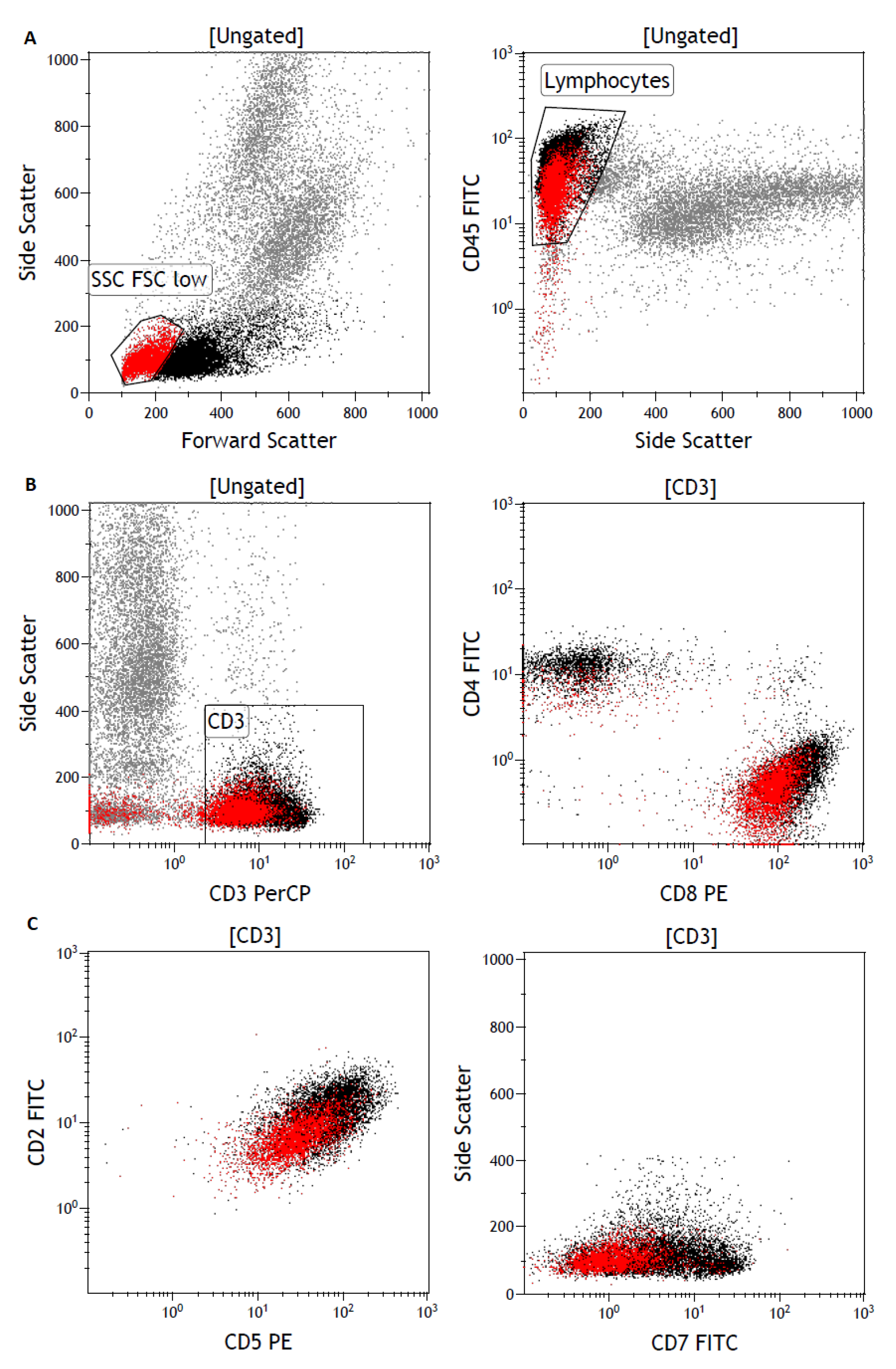 Diagnostics | Free Full-Text | Aberrant CD3-Positive, CD8-Low, CD7 ...
