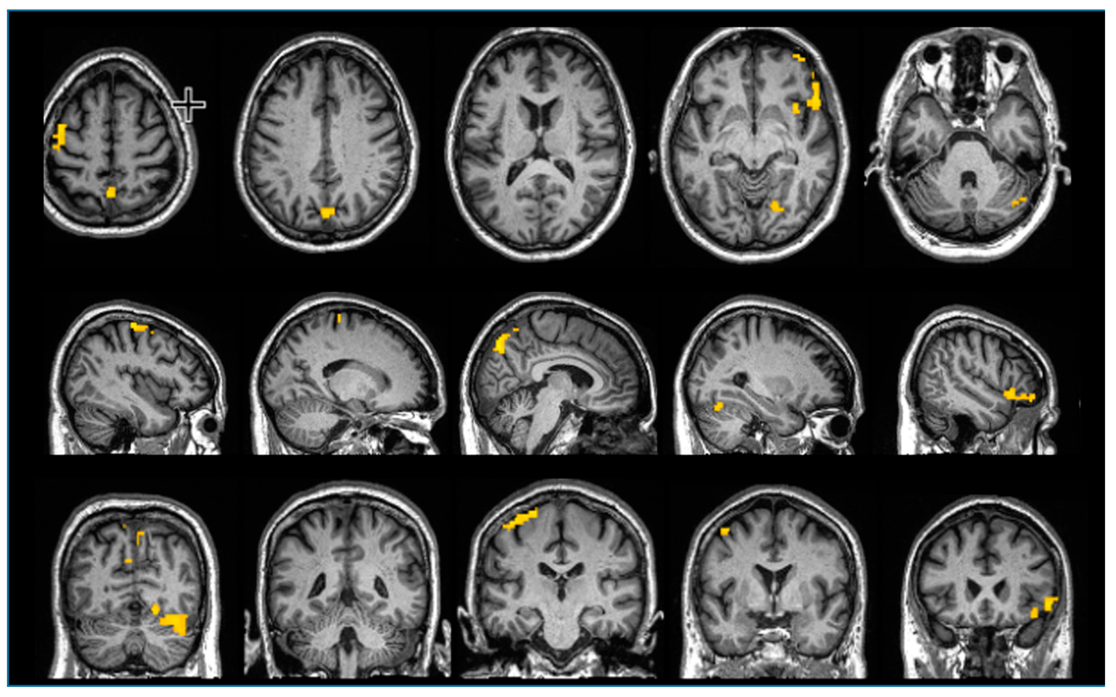 Magnetic Resonance Imaging Magnetic Resonance Imaging