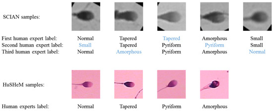 Deep Learning-Based Morphological Classification of Human Sperm Heads