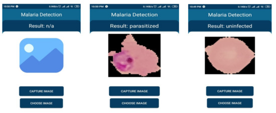 Deep Learning Based Automatic Malaria Parasite Detection from Blood ...