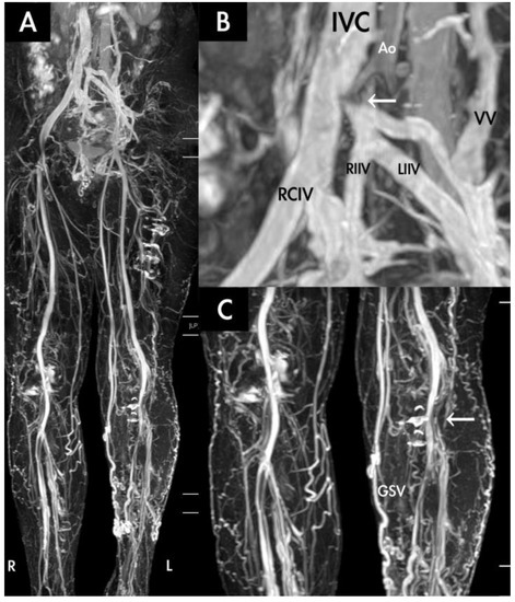 Novel Diagnostic Options without Contrast Media or Radiation: Triggered ...