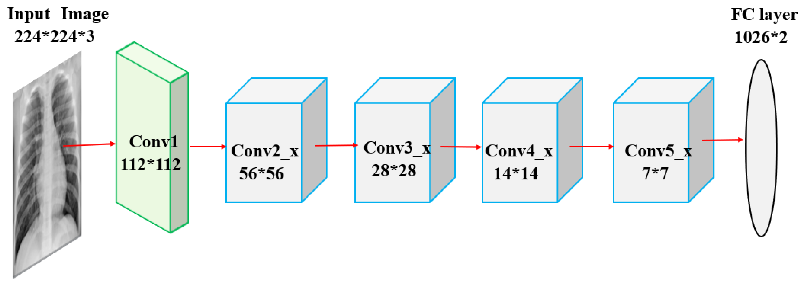 Efficient Pneumonia Detection in Chest Xray Images Using Deep Transfer ...