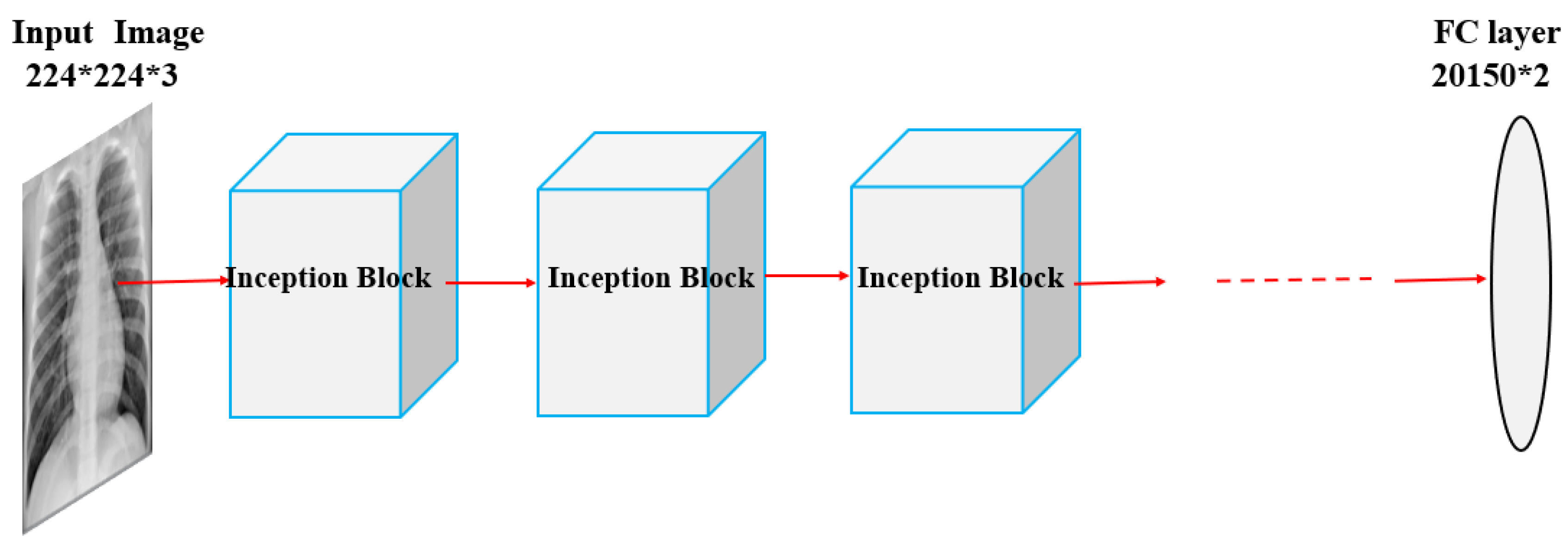 Efficient Pneumonia Detection in Chest Xray Images Using Deep Transfer ...