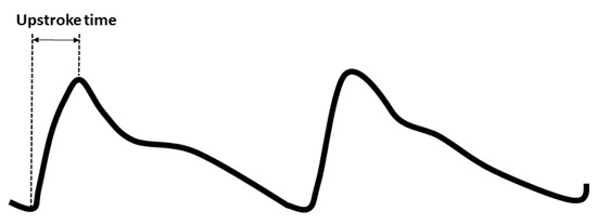 Upstroke Time as a Novel Predictor of Mortality in Patients with ...