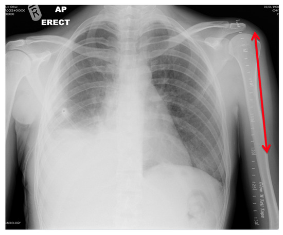 Diagnostics | Special Issue : Advances in Tracheal Intubation Diagnostics | Special Issue : Advances in Tracheal Intubation