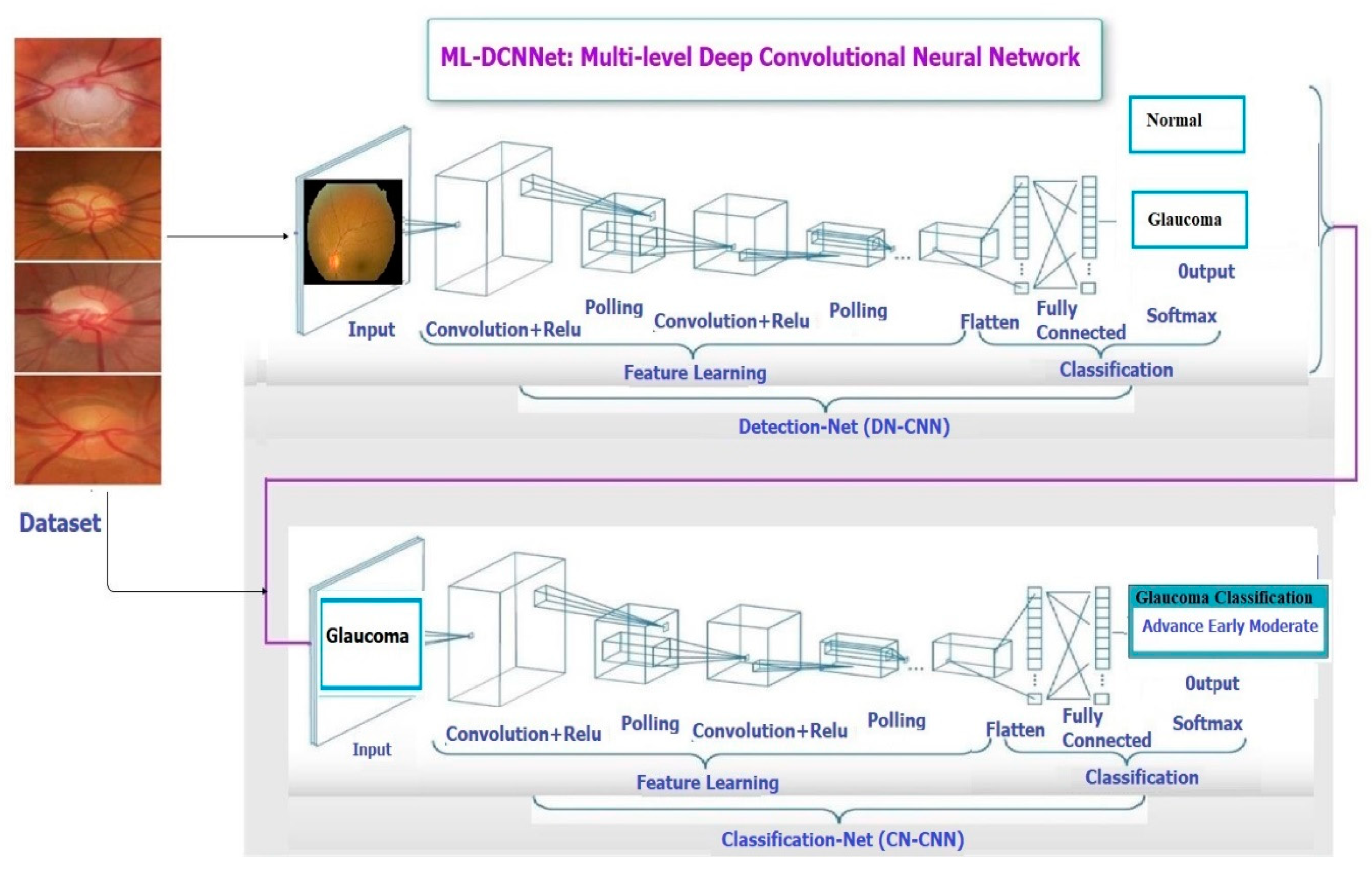 Diagnostics | Free Full-Text | An Adoptive Threshold-Based Multi-Level Deep Convolutional Neural ...