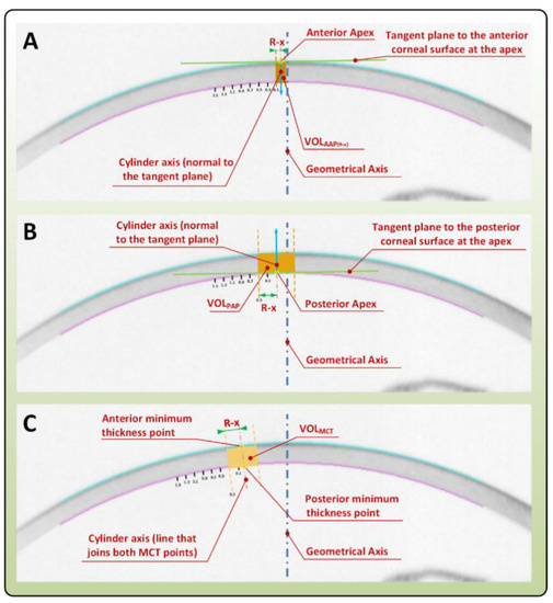 Relationship between Corneal Morphogeometrical Properties and ...