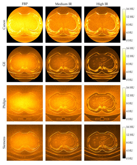 Spatial Distribution of Noise Reduction in Four Iterative Reconstruction Algorithms in CT—A ...