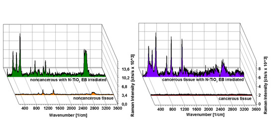 Diagnostics | Free Full-Text | Nitrogen-Doped Titanium Dioxide ...