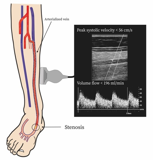Diagnostics | Free Full-Text | Volume Flow and Peak Systolic Velocity ...