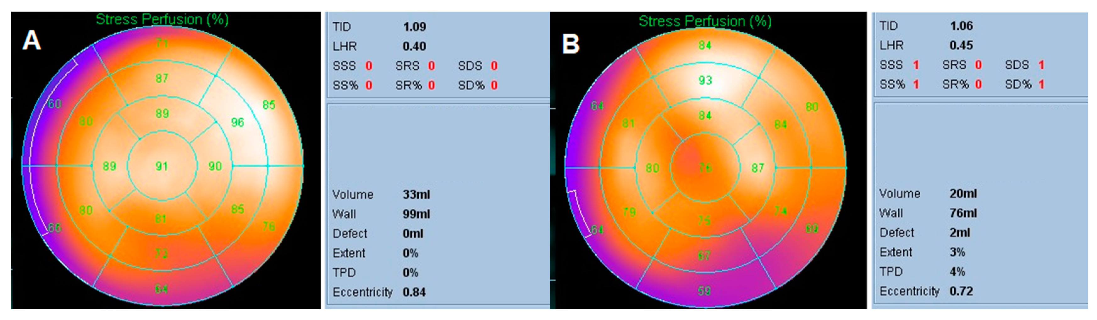 Relationship between Semi-Quantitative Parameters of Thallium-201 ...