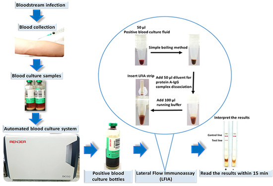 Diagnostics | Special Issue : Lateral Flow Immunoassays