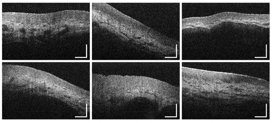 In Vivo Endoscopic Optical Coherence Tomography of the Healthy Human ...