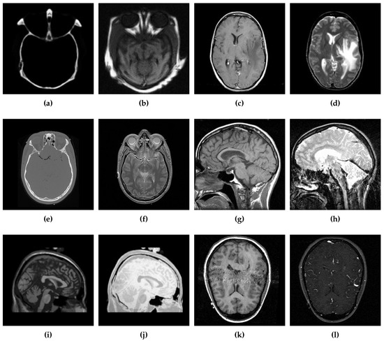 Diagnostics | Free Full-Text | CSID: A Novel Multimodal Image Fusion ...