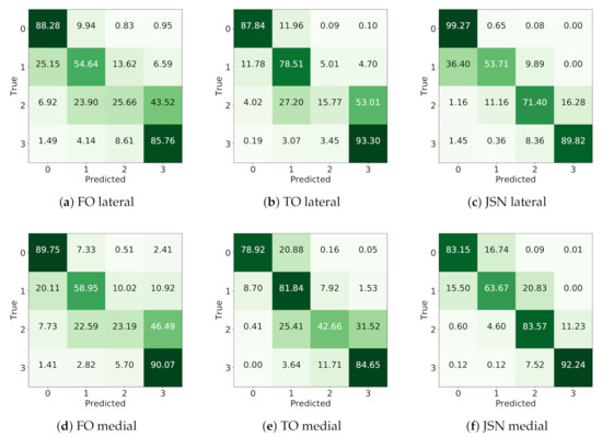 Automatic Grading of Individual Knee Osteoarthritis Features in Plain ...