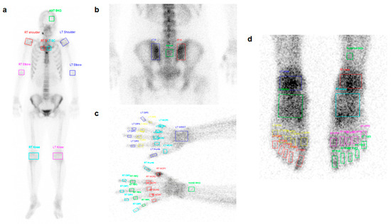 Diagnostics | Free Full-Text | Clinical Use of Quantitative Analysis of ...
