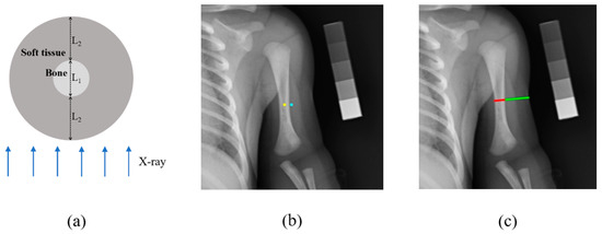 Convolutional Neural Network-Based Humerus Segmentation and Application to Bone Mineral Density ...