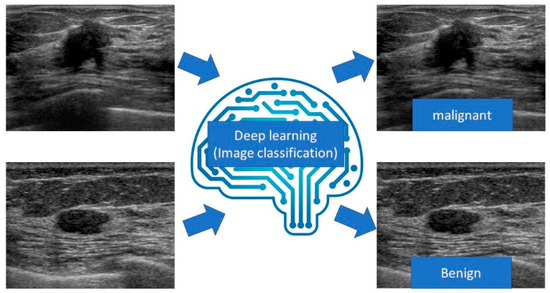 The Utility of Deep Learning in Breast Ultrasonic Imaging: A Review