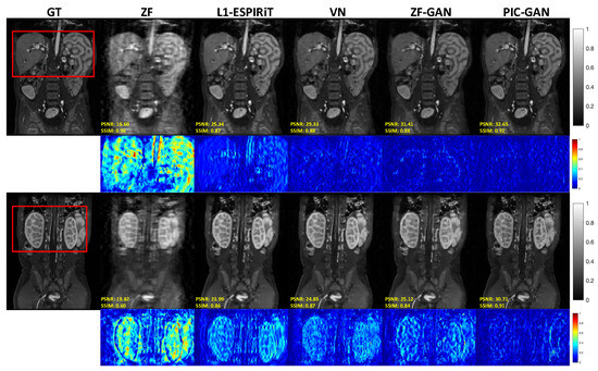 Diagnostics | Free Full-Text | PIC-GAN: A Parallel Imaging Coupled ...