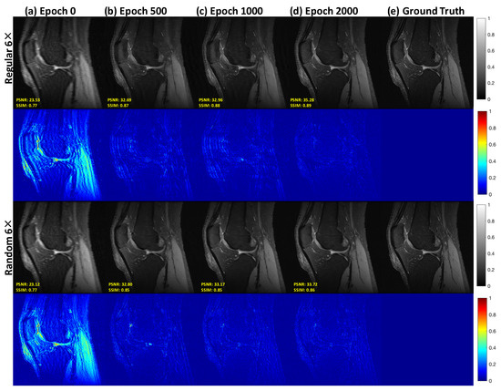Diagnostics | Free Full-Text | PIC-GAN: A Parallel Imaging Coupled ...