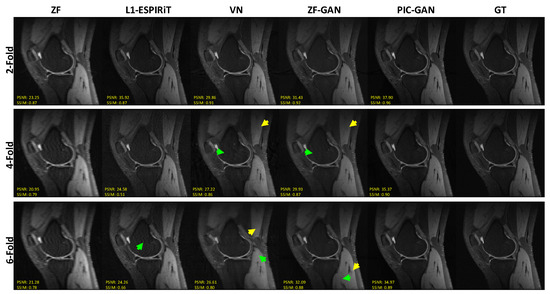 Diagnostics | Free Full-Text | PIC-GAN: A Parallel Imaging Coupled ...