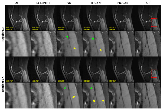Diagnostics | Free Full-Text | PIC-GAN: A Parallel Imaging Coupled ...