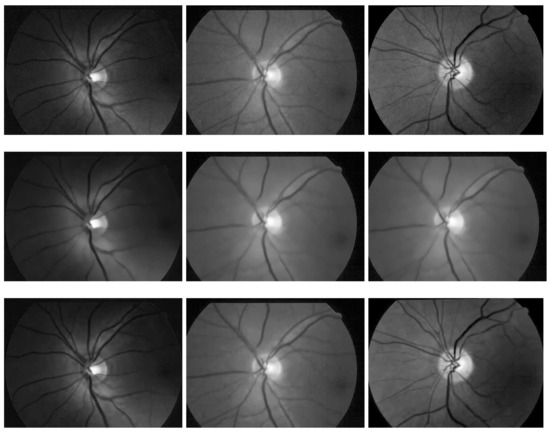 Towards Automated Eye Diagnosis: An Improved Retinal Vessel ...